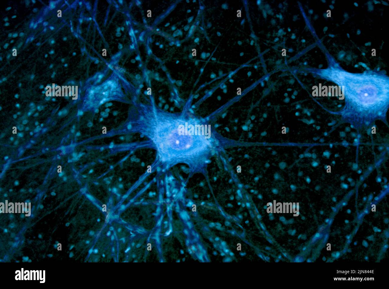 Nerve cells, light micrograph Stock Photo - Alamy