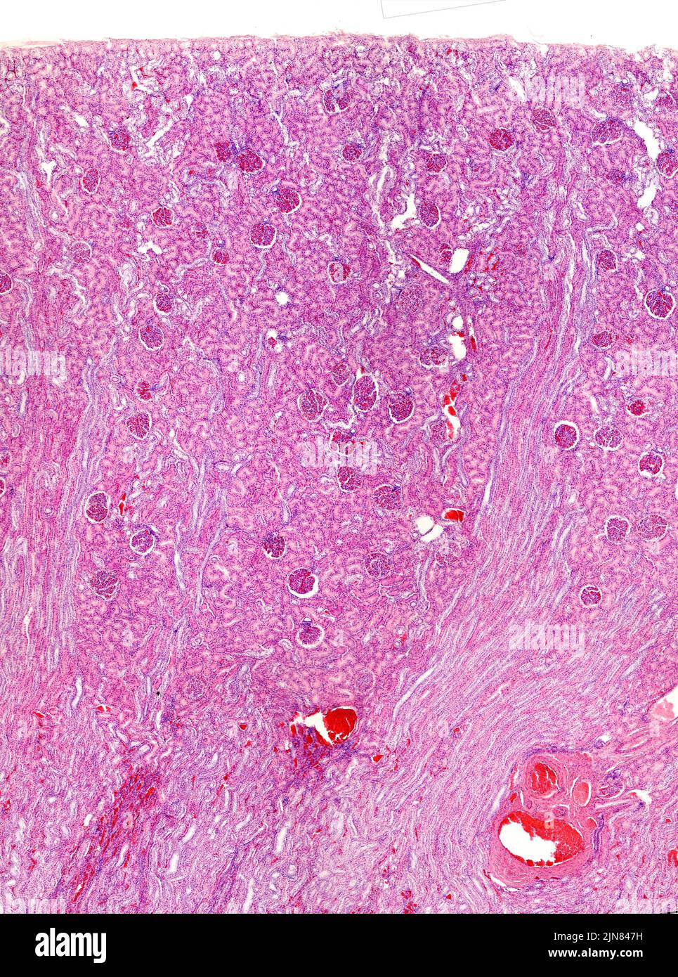 Human kidney, light micrograph Stock Photo - Alamy