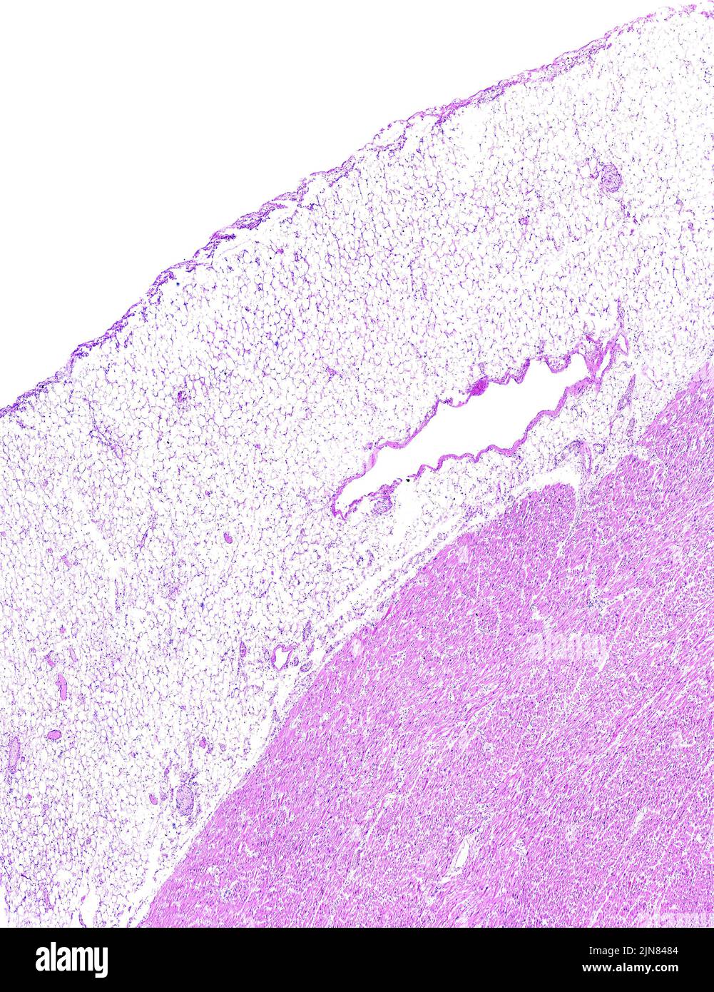 Human pericardium, light micrograph Stock Photo - Alamy