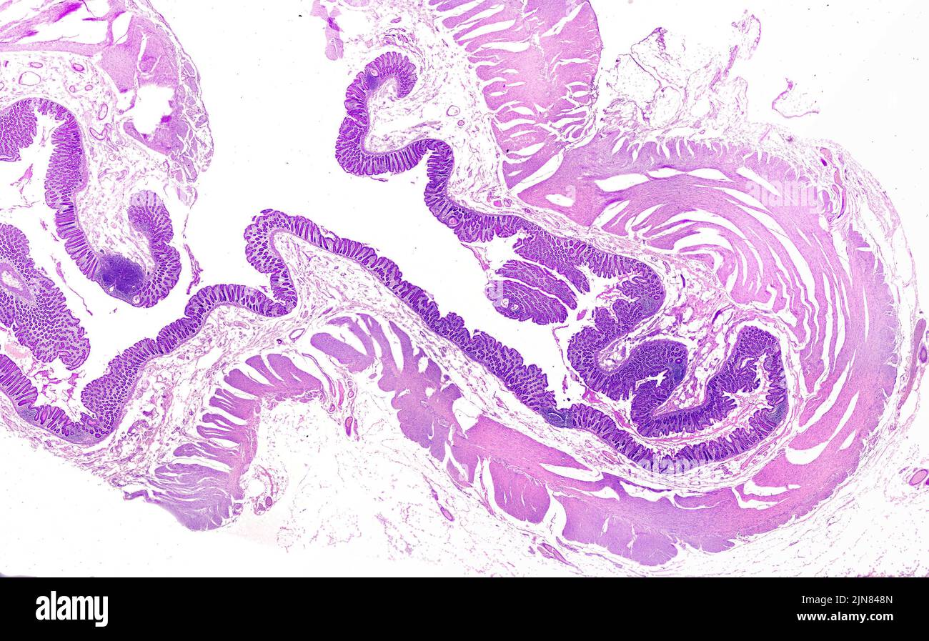 Human large bowel, light micrograph Stock Photo - Alamy