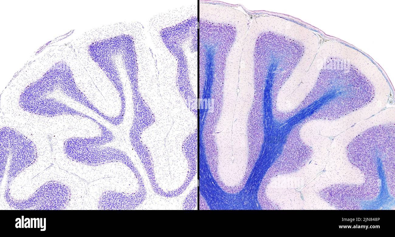 Cerebellum, light micrograph Stock Photo - Alamy