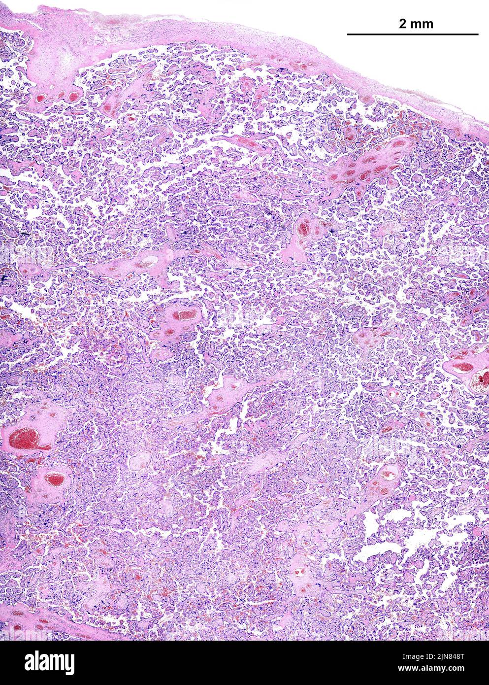 Human placenta, light micrograph Stock Photo - Alamy