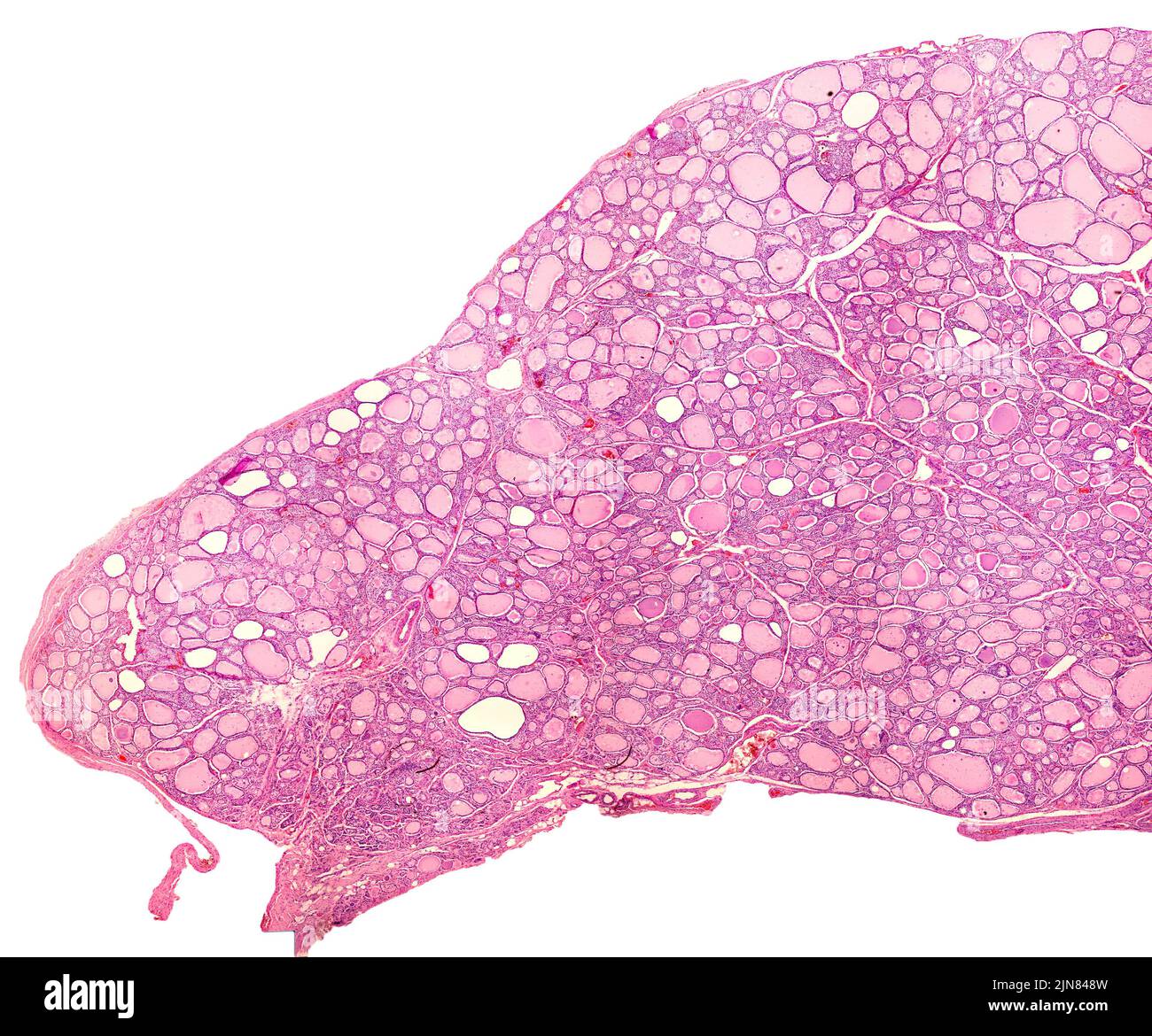 Human thyroid gland, light micrograph Stock Photo - Alamy