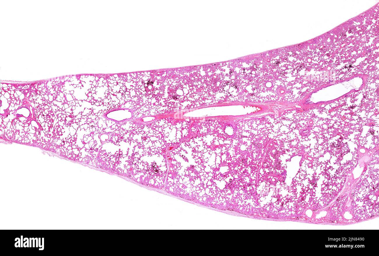 Human lung, light micrograph Stock Photo - Alamy