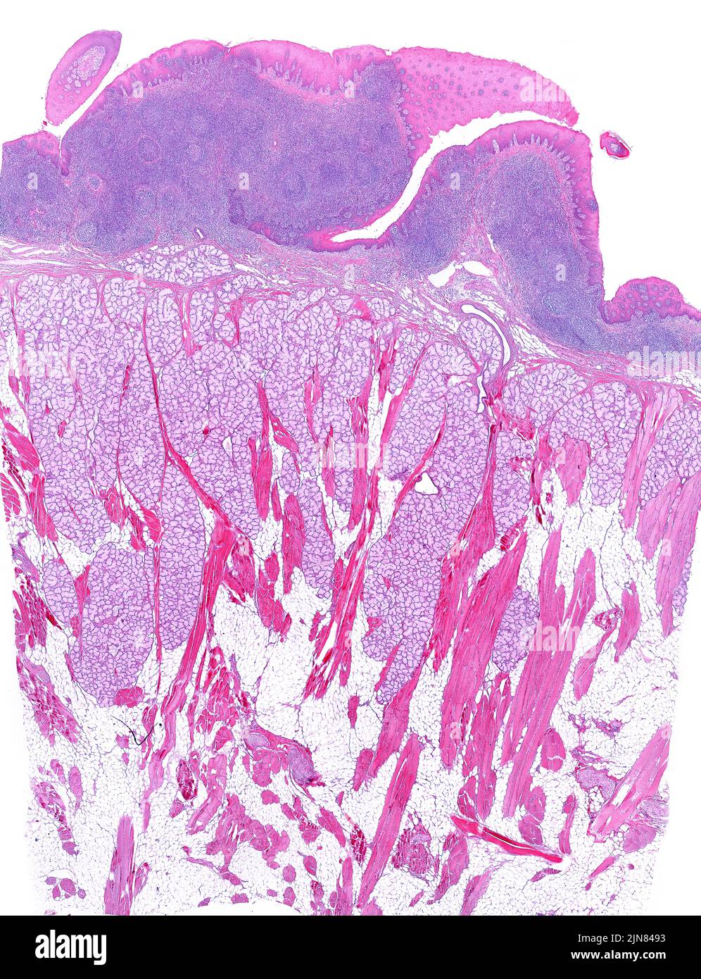 Human lingual tonsil, light micrograph Stock Photo - Alamy