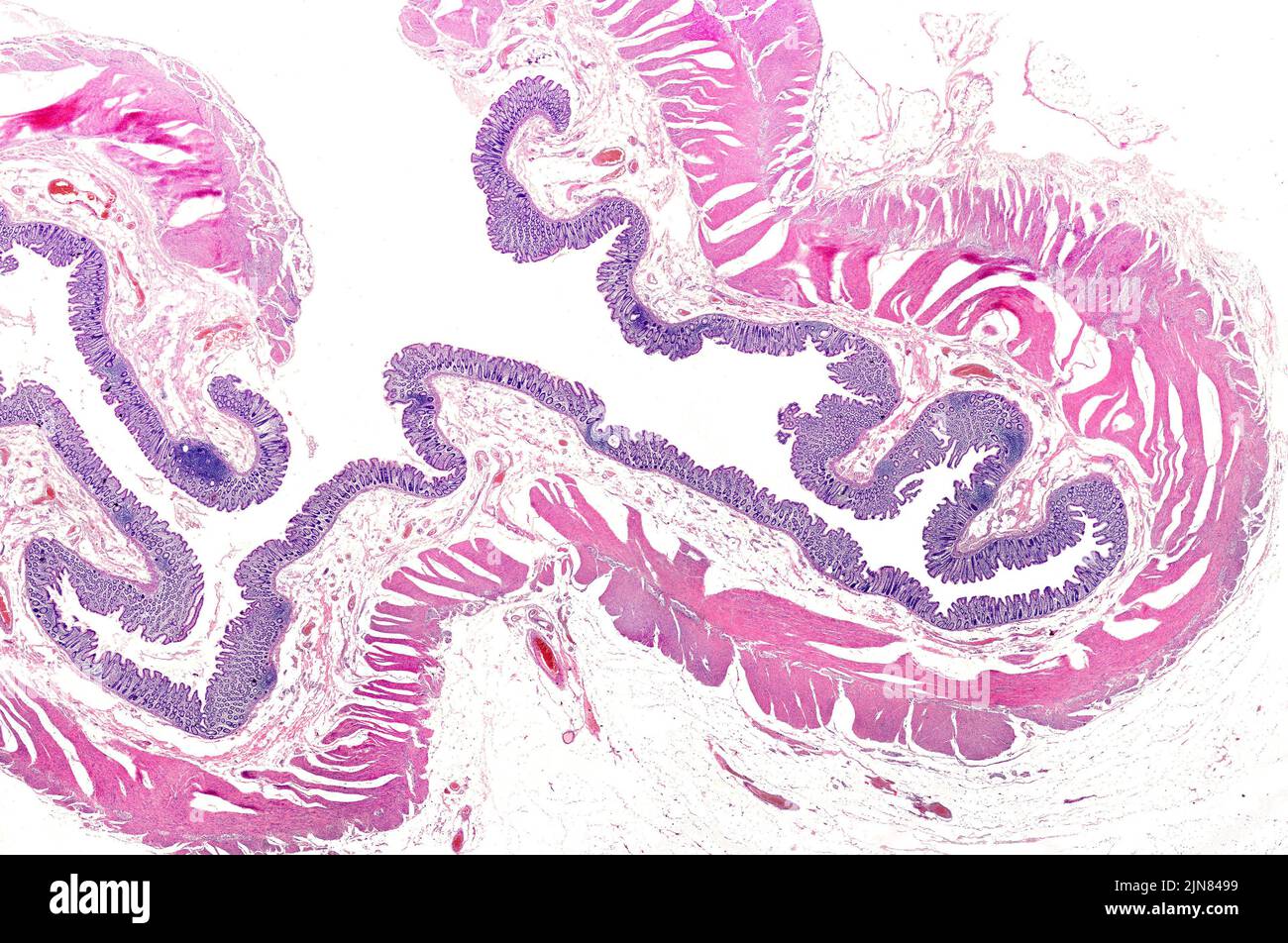 Human large bowel, light micrograph Stock Photo - Alamy