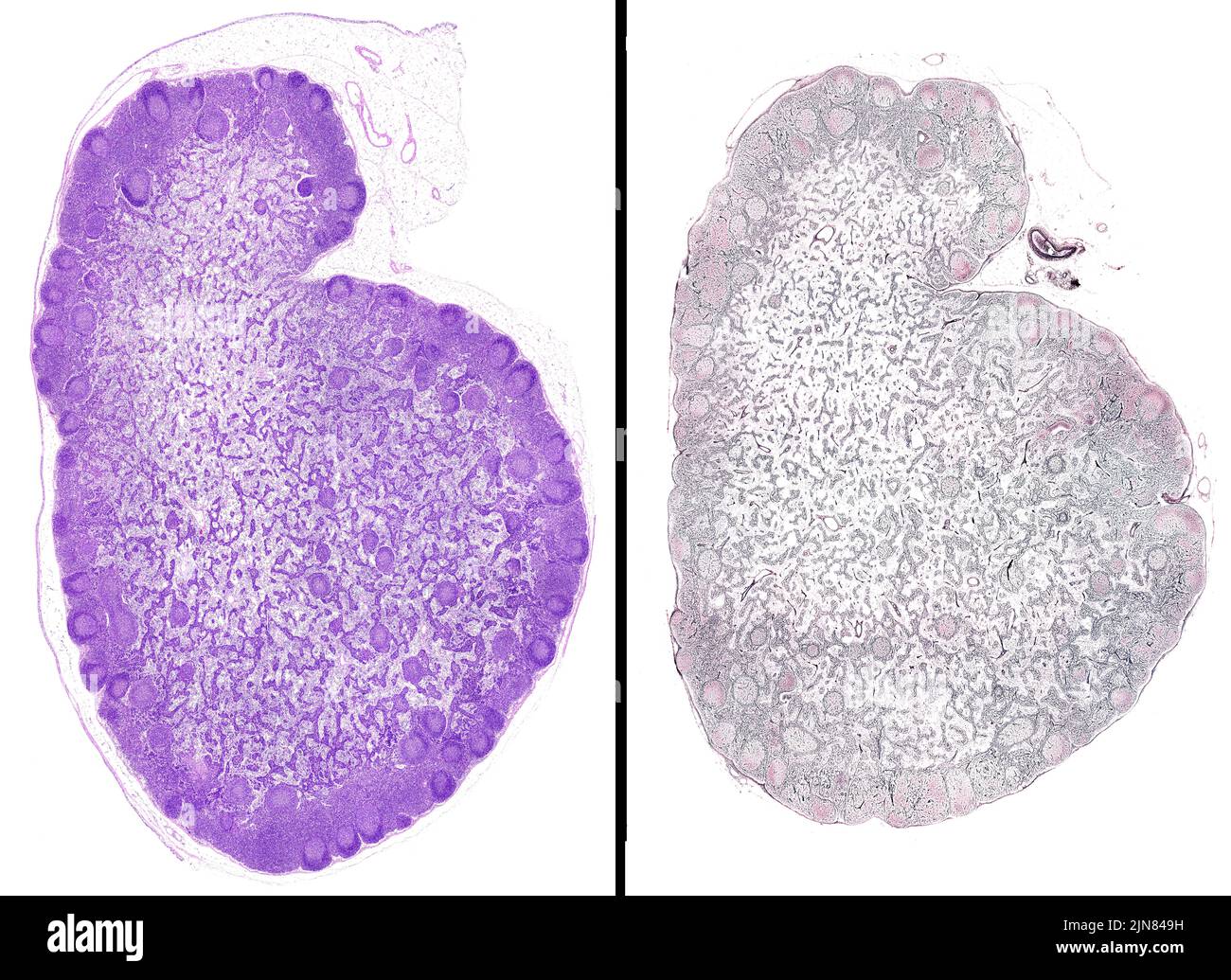 Lymph node, light micrograph Stock Photo - Alamy