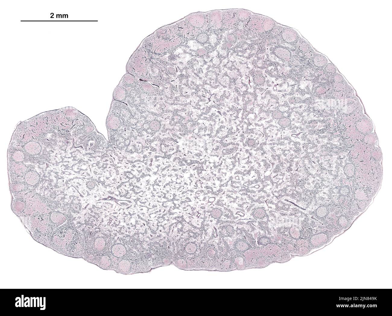 Reticular fibres in lymph node, light micrograph Stock Photo - Alamy