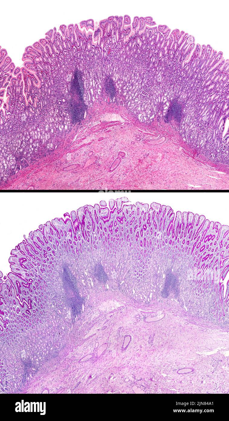 Stomach, light micrograph Stock Photo - Alamy