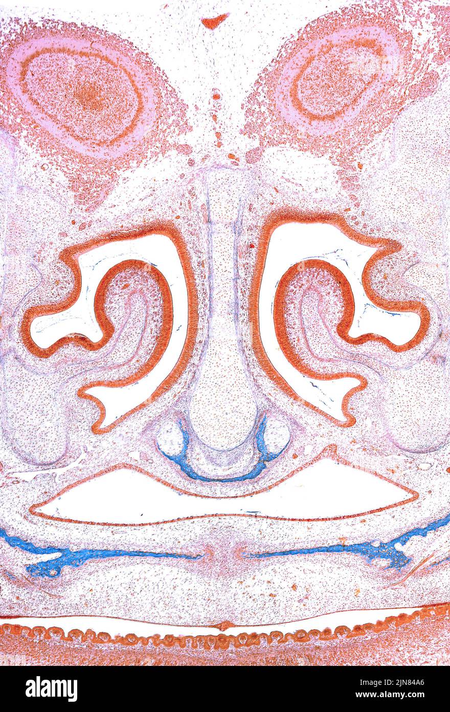 Rabbit foetus head, light micrograph Stock Photo - Alamy