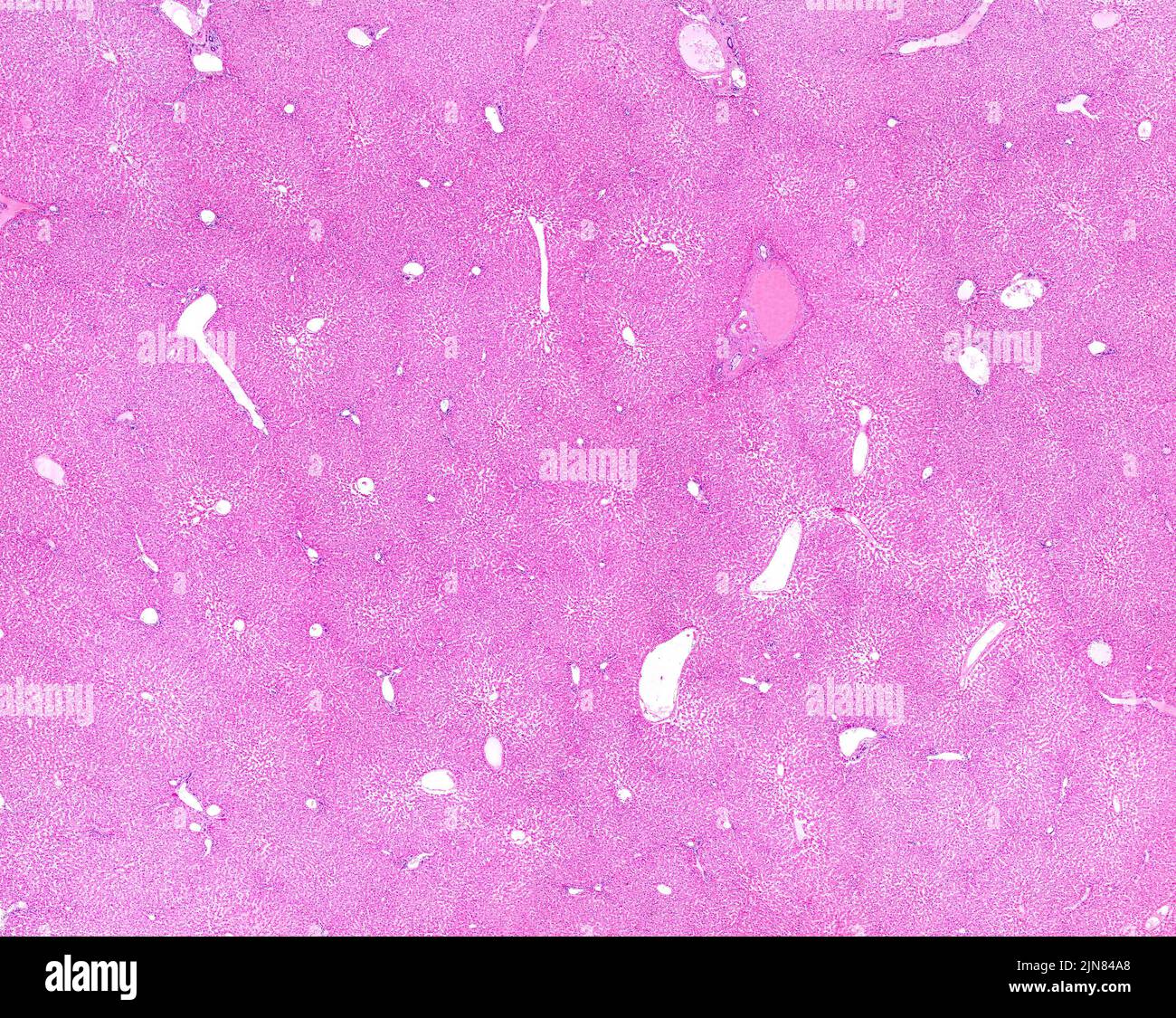 Human liver, light micrograph Stock Photo - Alamy