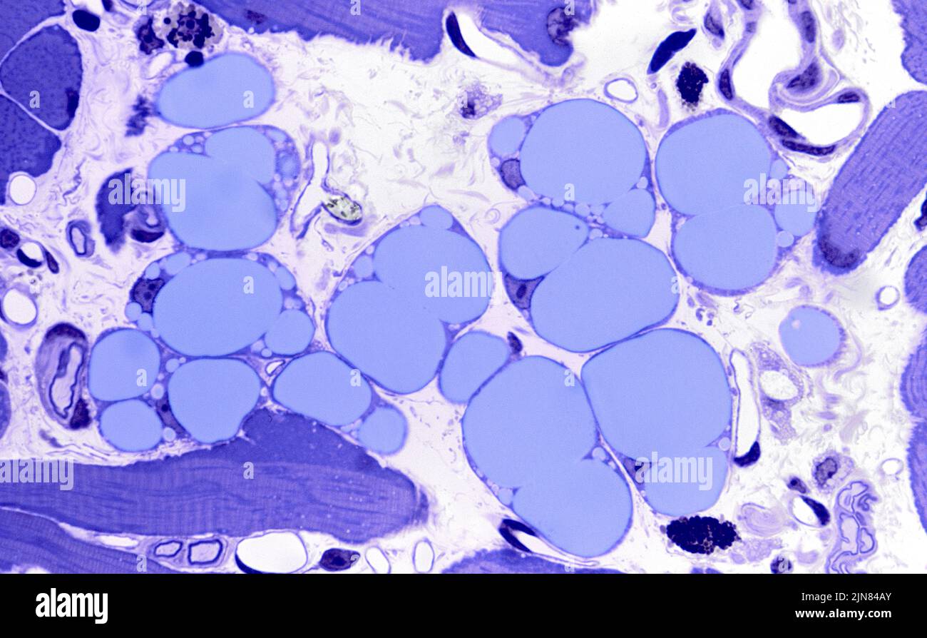 Fat cells, light micrograph Stock Photo - Alamy