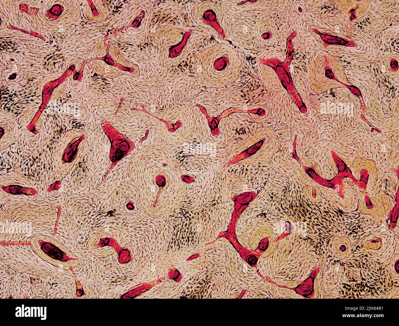Bone tissue, light micrograph Stock Photo - Alamy