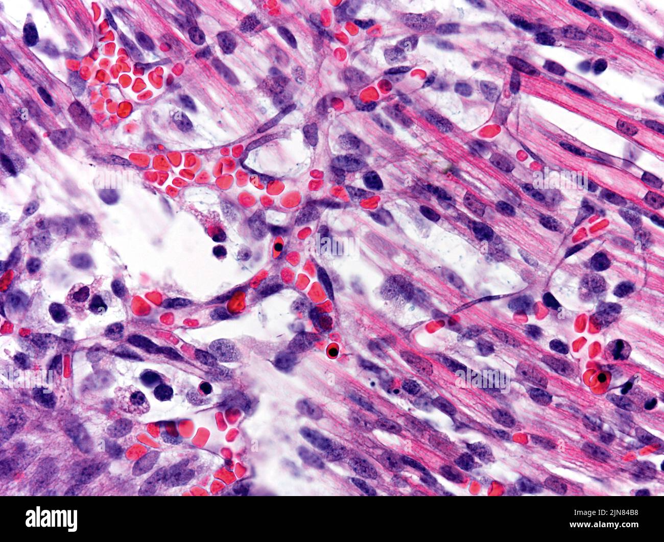 Capillaries, light micrograph Stock Photo - Alamy