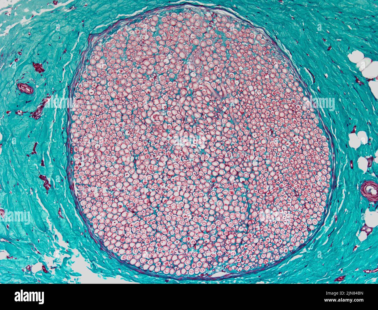 Nerve tissue, light micrograph Stock Photo - Alamy
