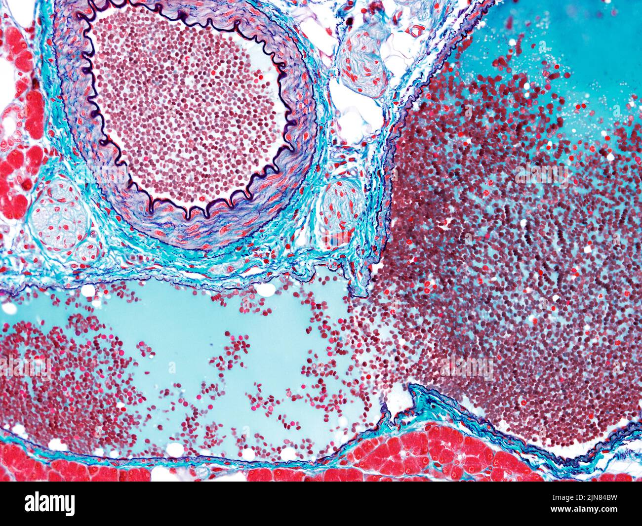 Blood vessels, light micrograph Stock Photo - Alamy