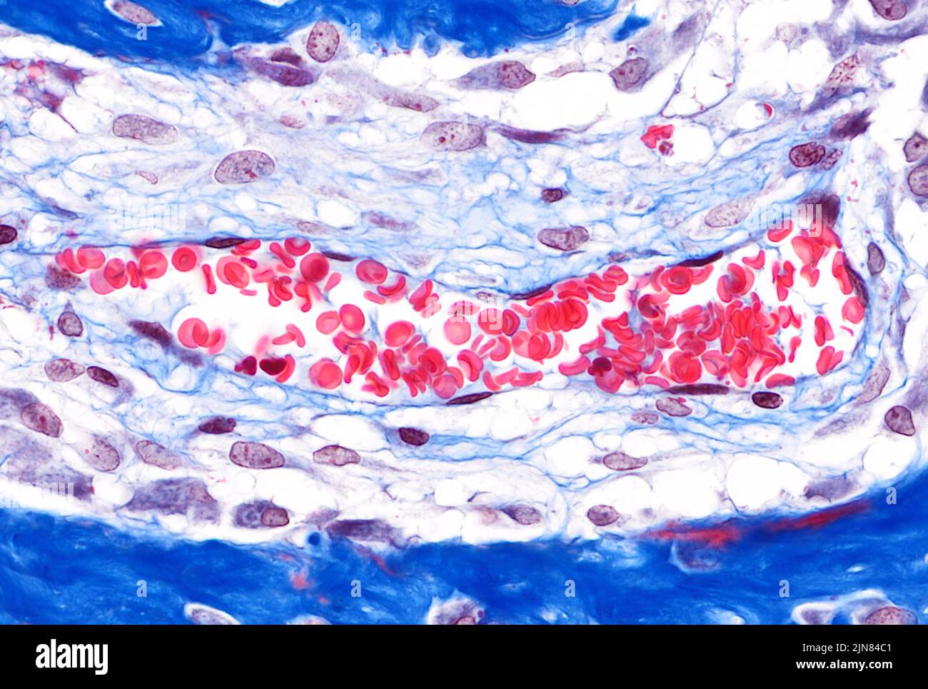 Blood vessel, light micrograph Stock Photo - Alamy