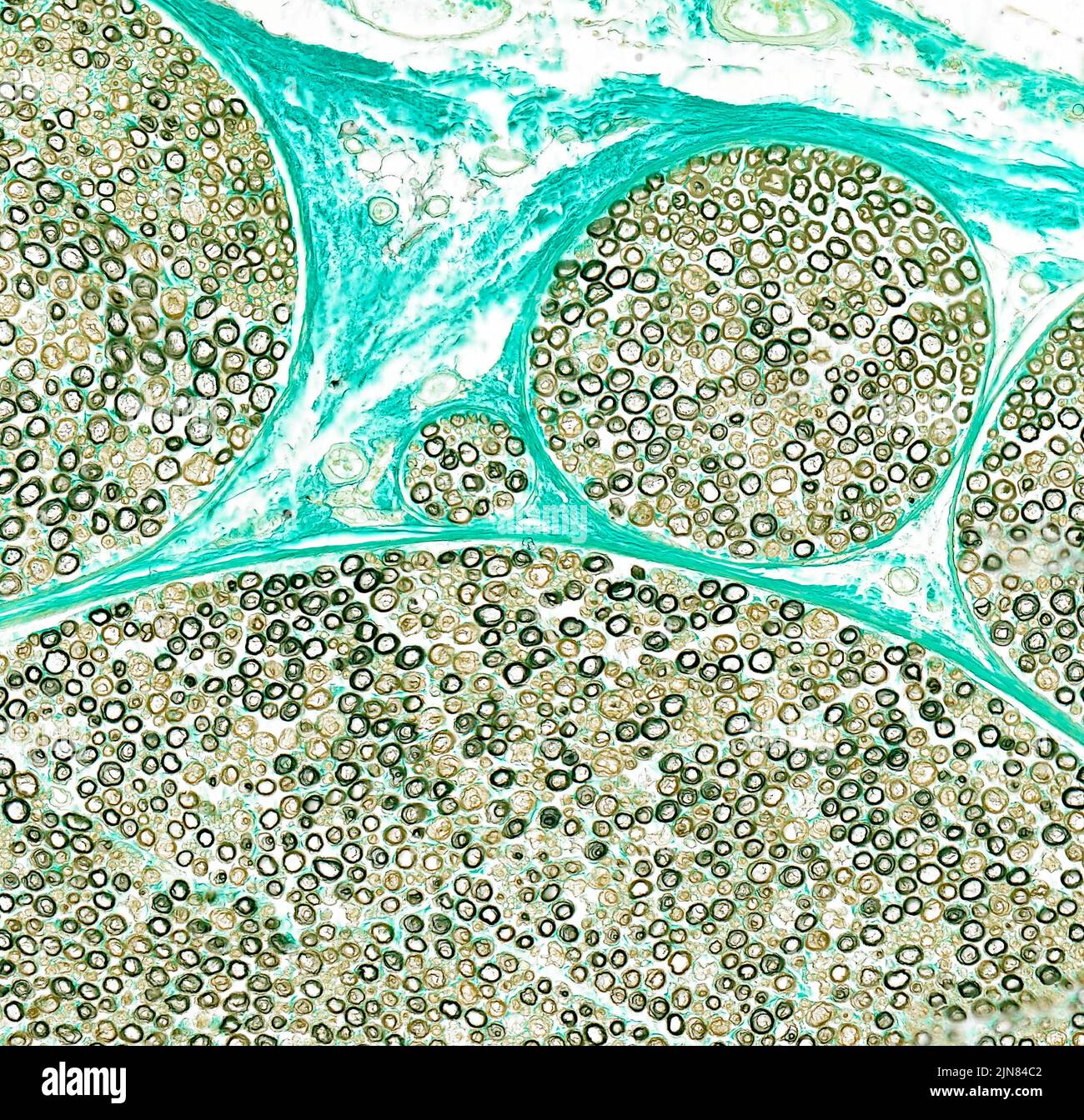 Peripheral nerves, light micrograph Stock Photo - Alamy