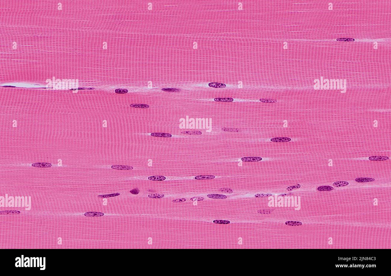 Skeletal muscle, light micrograph Stock Photo - Alamy Skeletal muscle, light micrograph Stock Photo - Alamy