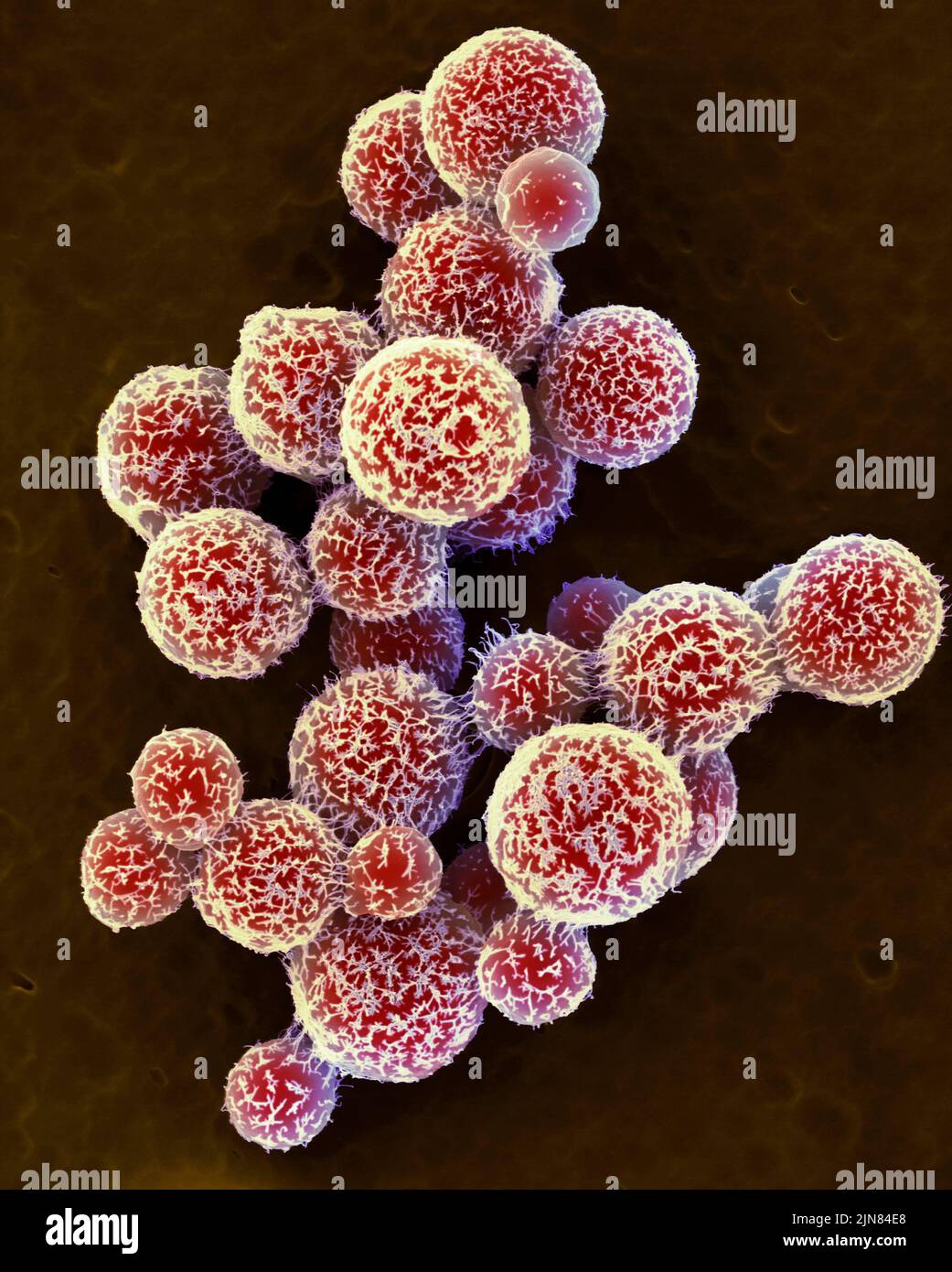 Cryptococcus neoformans yeast, SEM Stock Photo - Alamy