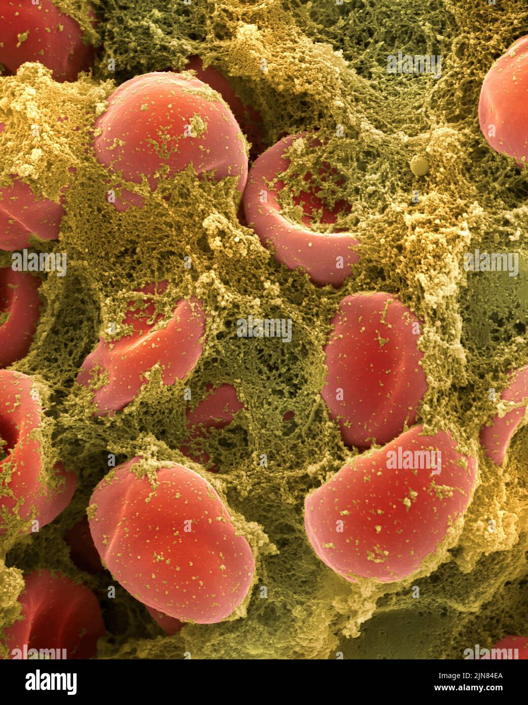 Blood clot, SEM Stock Photo - Alamy