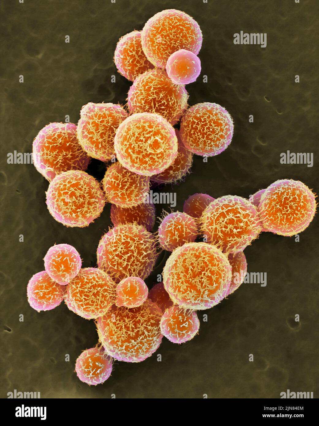 Cryptococcus neoformans yeast, SEM Stock Photo - Alamy