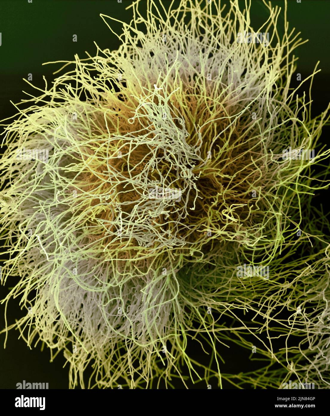 Trichophyton rubrum fungus, SEM Stock Photo - Alamy