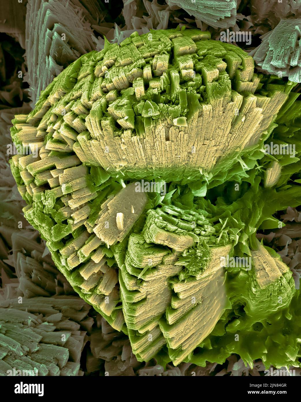 Kidney stone, SEM Stock Photo - Alamy