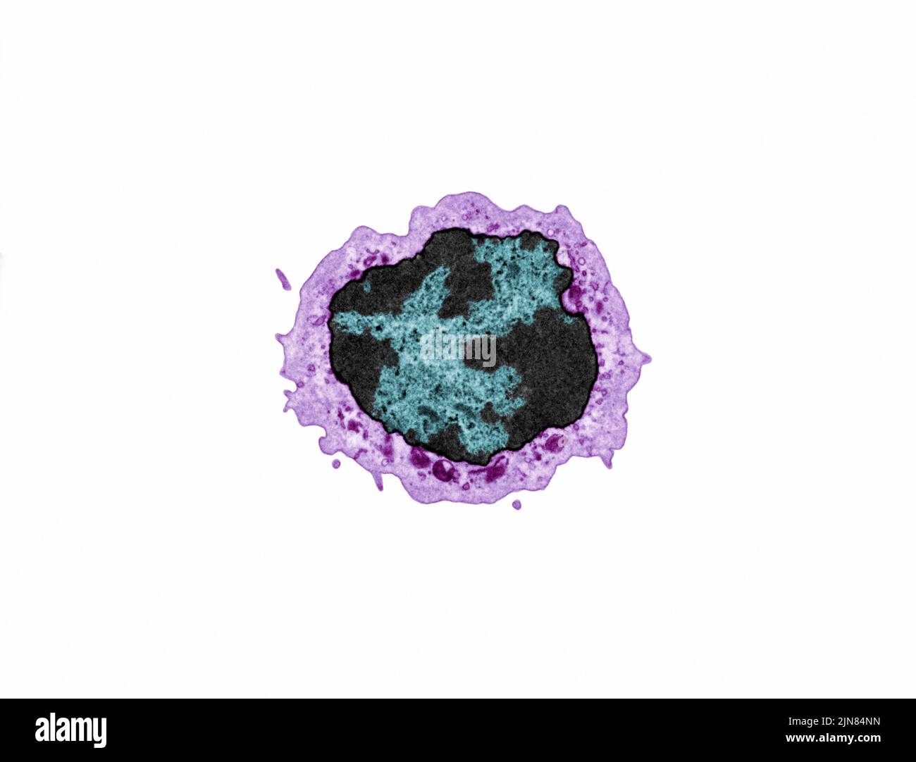 White blood cell, TEM Stock Photo - Alamy
