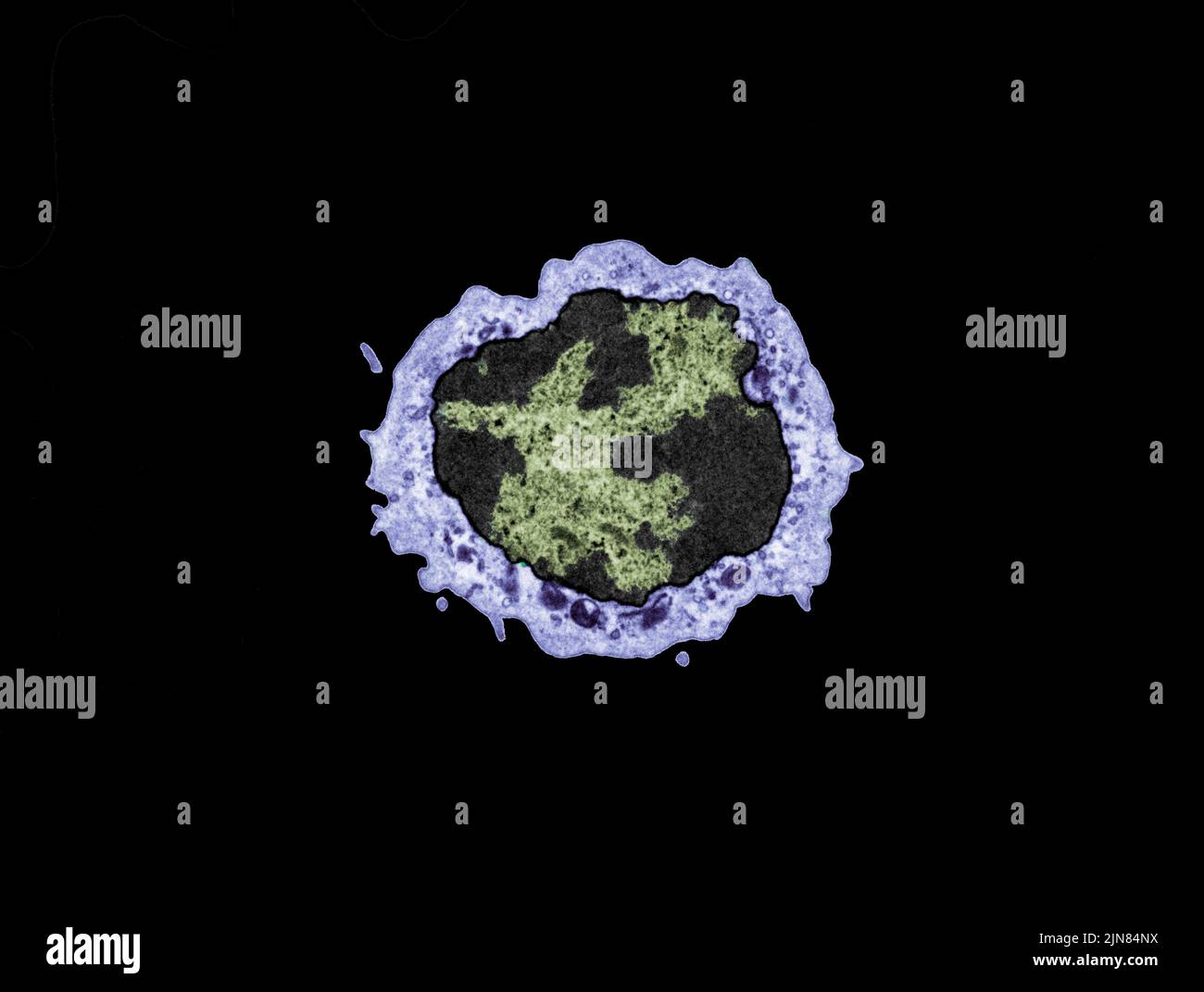 White blood cell, TEM Stock Photo - Alamy
