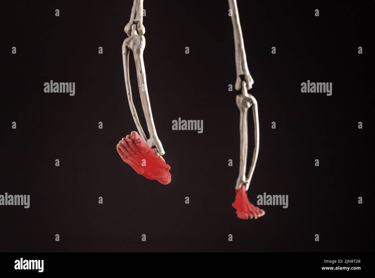 Human skeleton legs with painful feet with red point on black ...