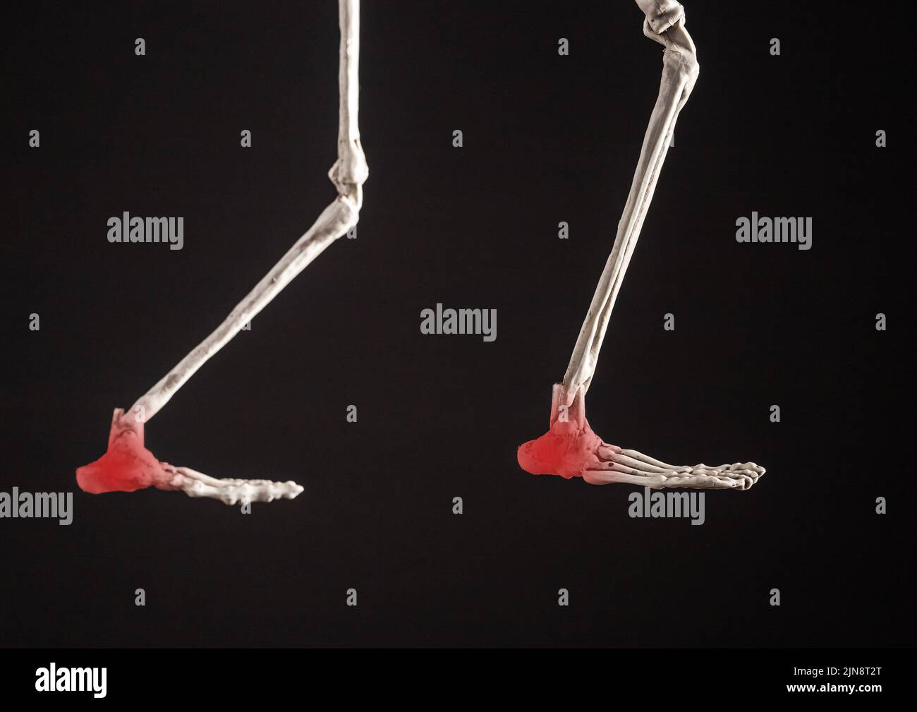 Human skeleton legs with painful heel with red spot on black background ...