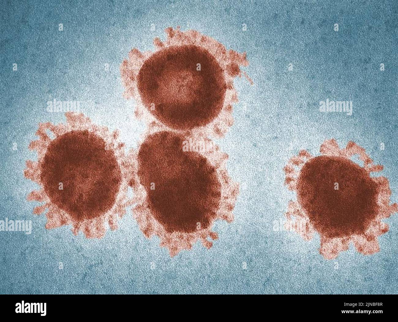 TEM of avian infectious bronchitis virus rotated cropped Stock Photo ...