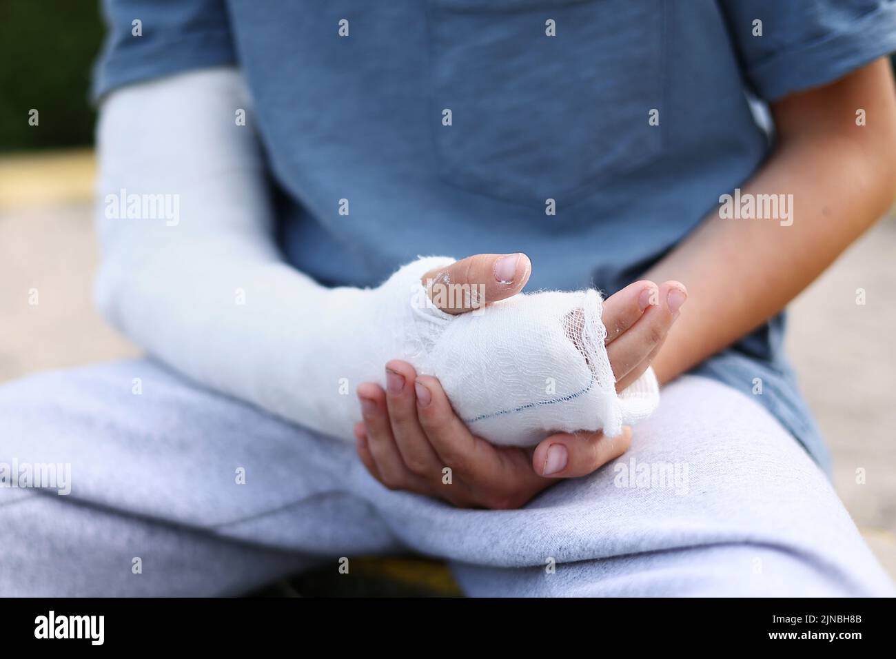a child's arm is broken. little boy with a fractured limb outdoors ...