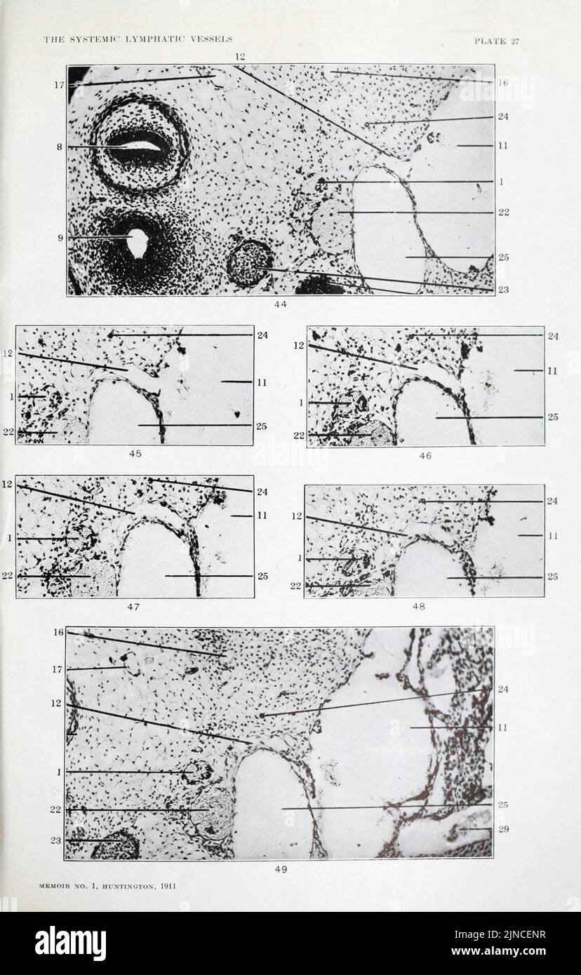 The anatomy and development of the systemic lymphatic vessels in the ...