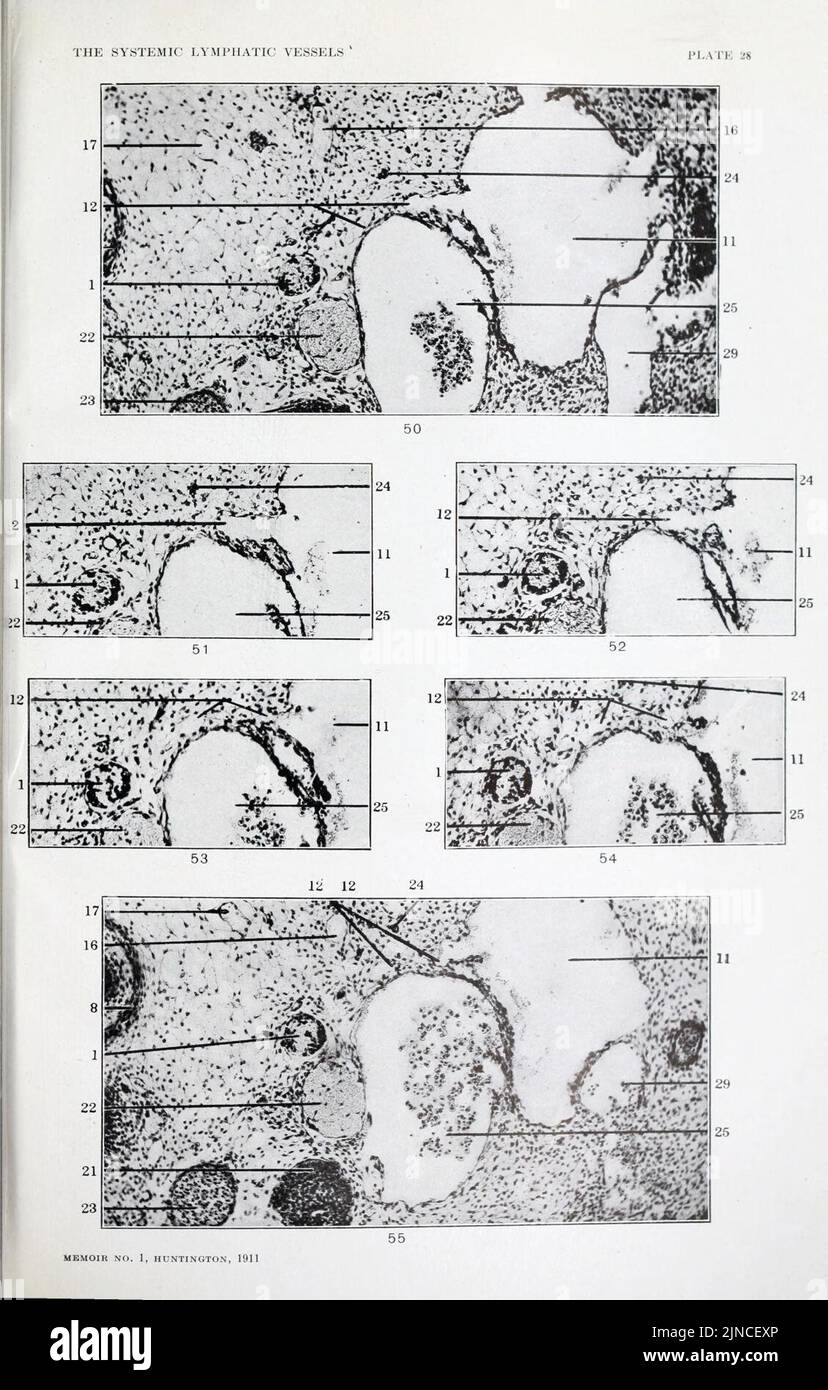 The anatomy and development of the systemic lymphatic vessels in the ...