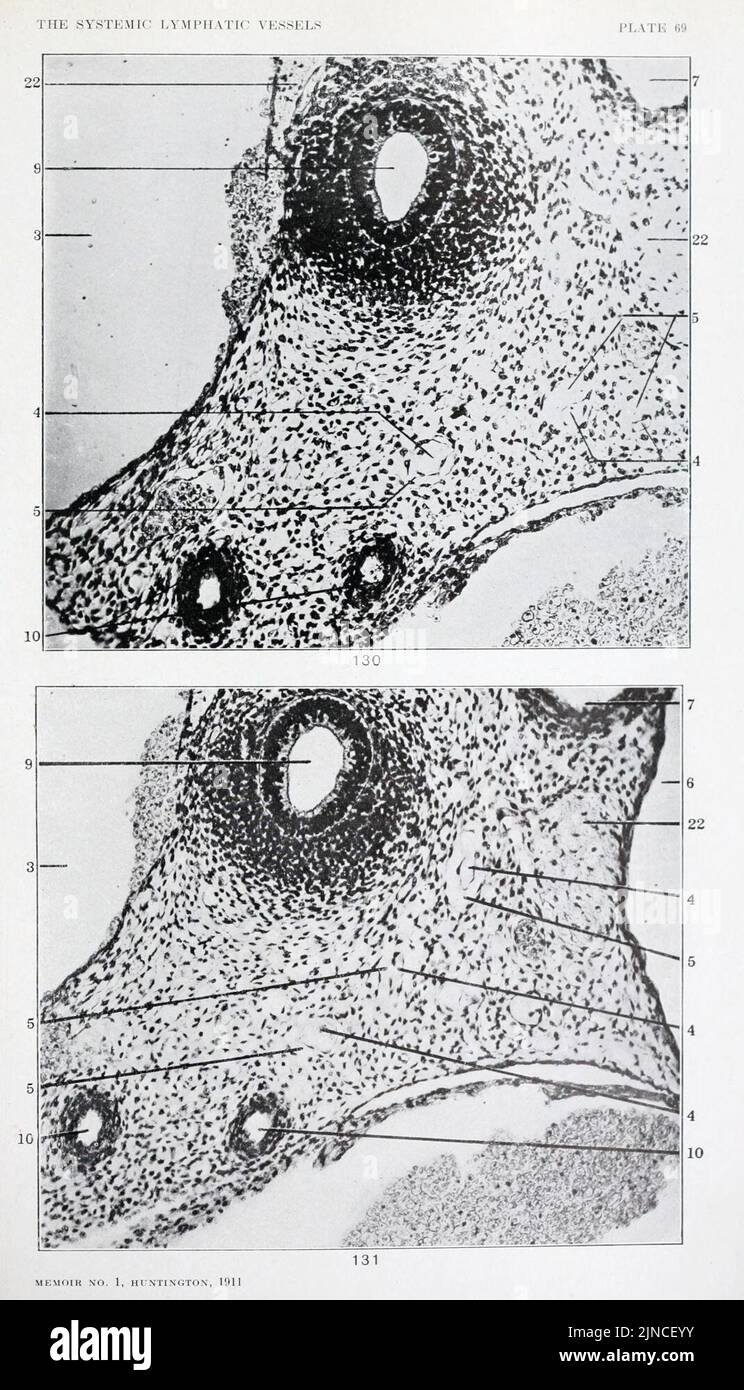 The anatomy and development of the systemic lymphatic vessels in the ...