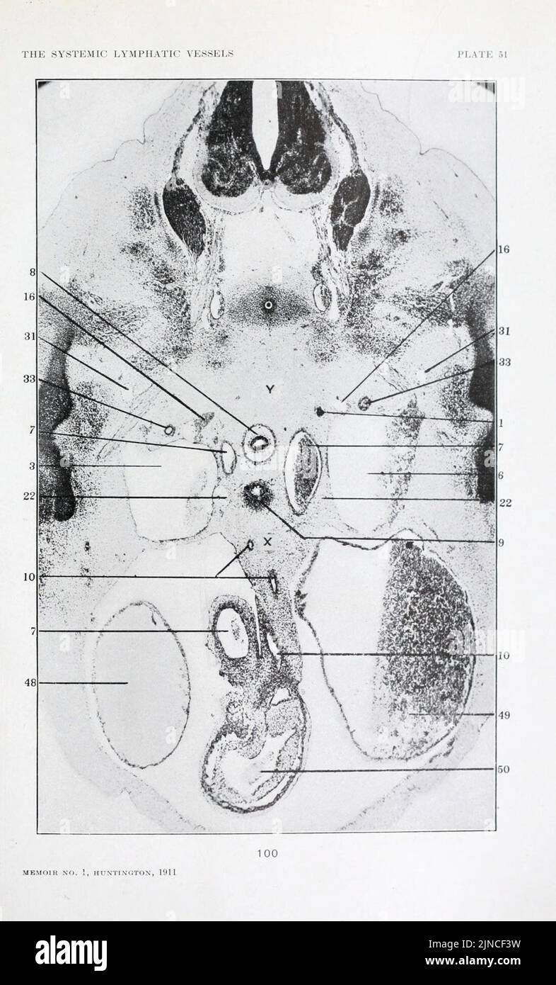 The anatomy and development of the systemic lymphatic vessels in the ...