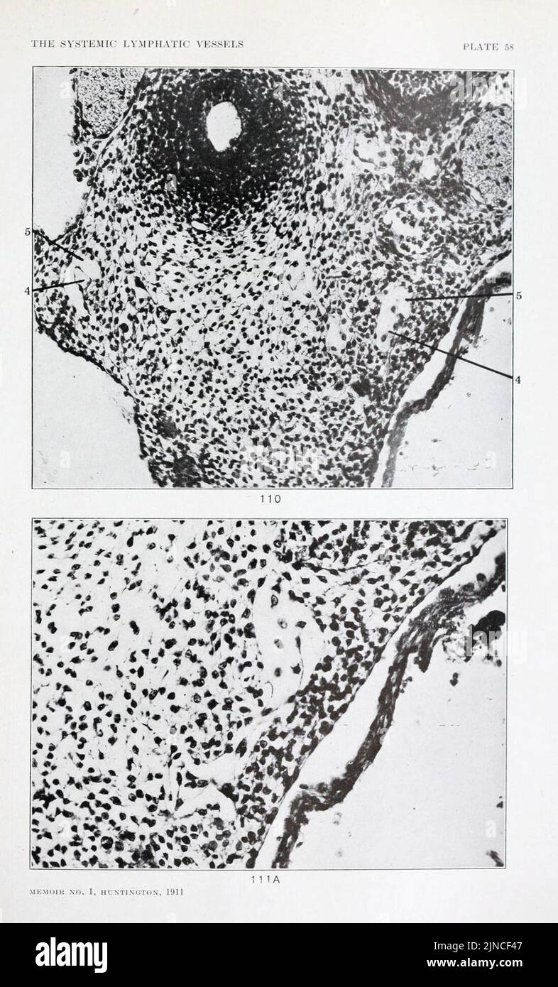 The anatomy and development of the systemic lymphatic vessels in the ...