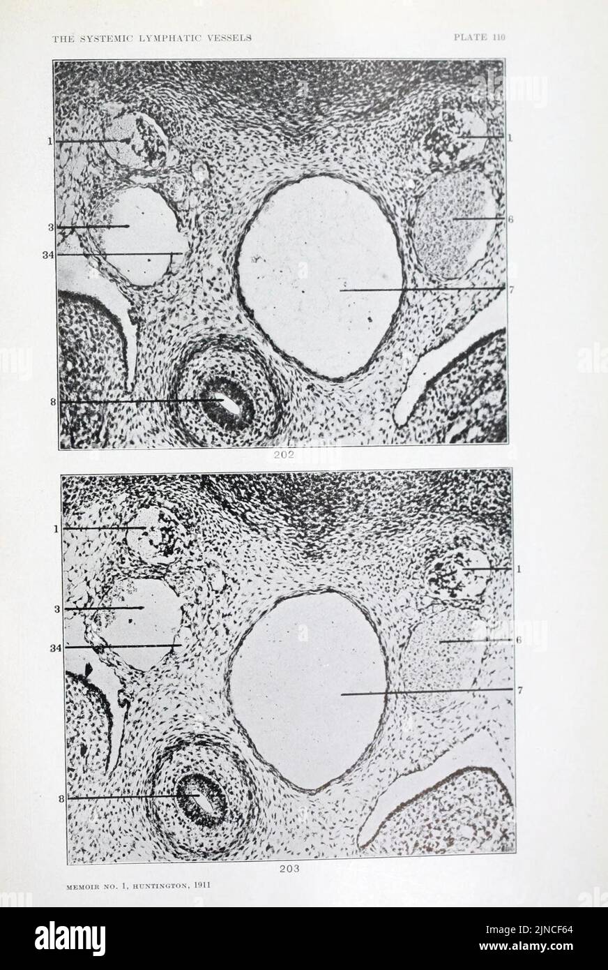 The anatomy and development of the systemic lymphatic vessels in the ...
