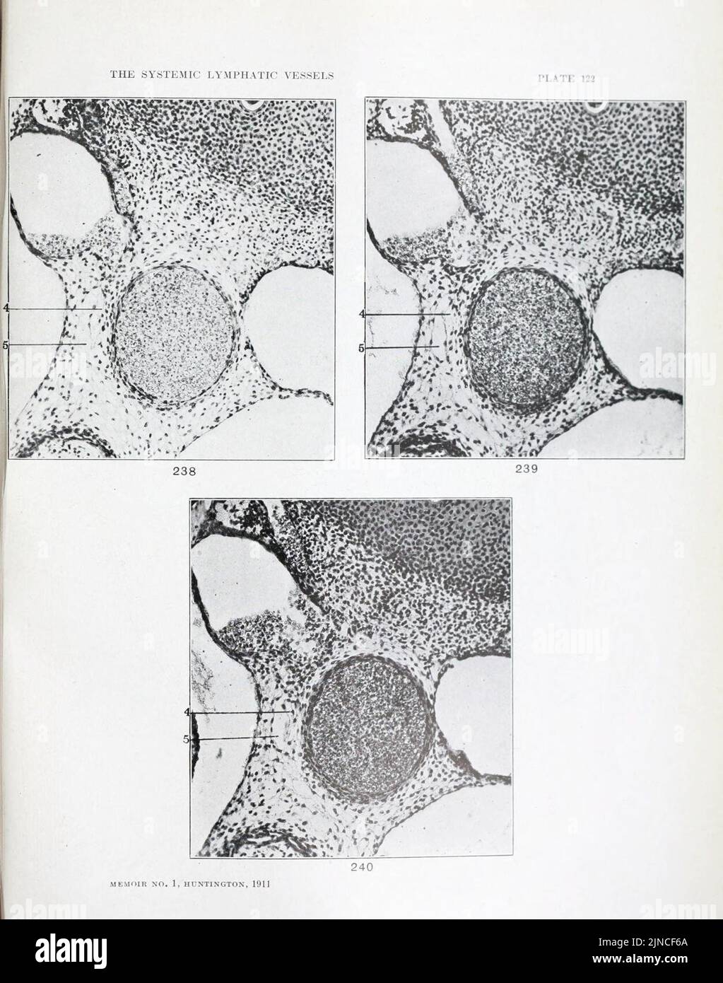 The anatomy and development of the systemic lymphatic vessels in the ...
