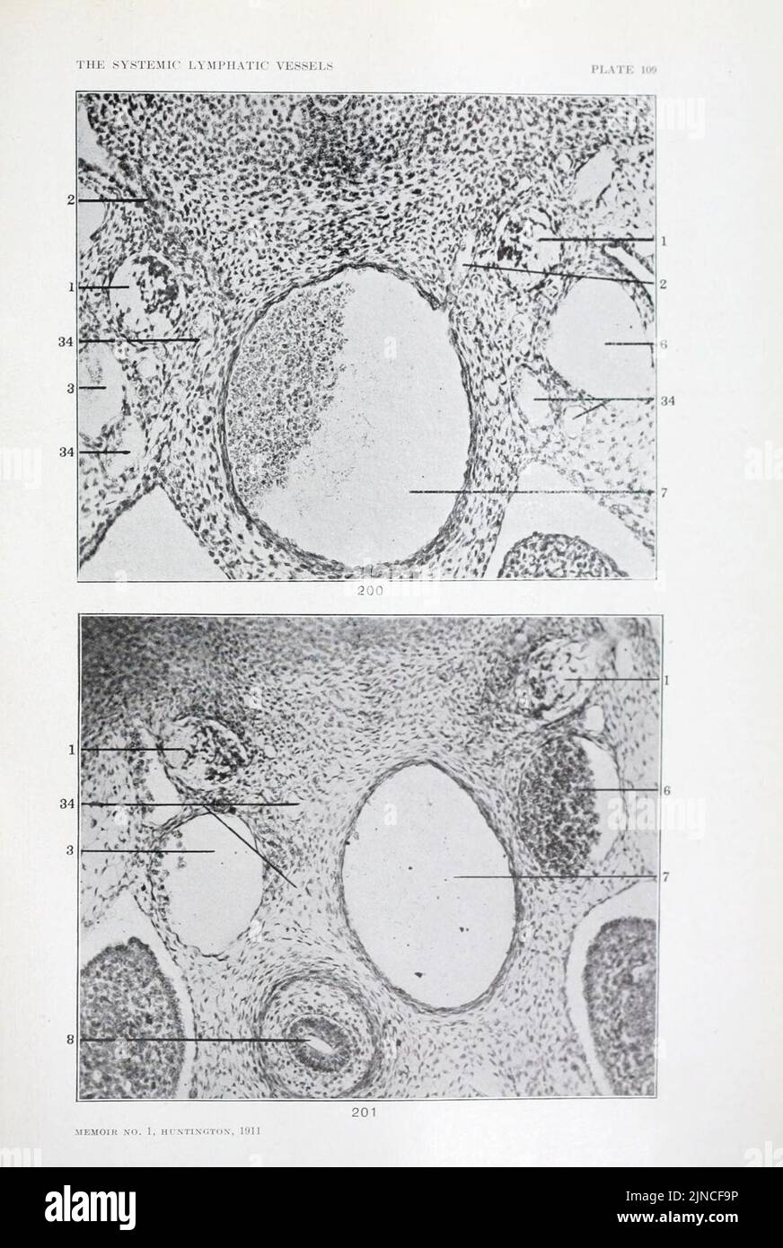 The anatomy and development of the systemic lymphatic vessels in the ...