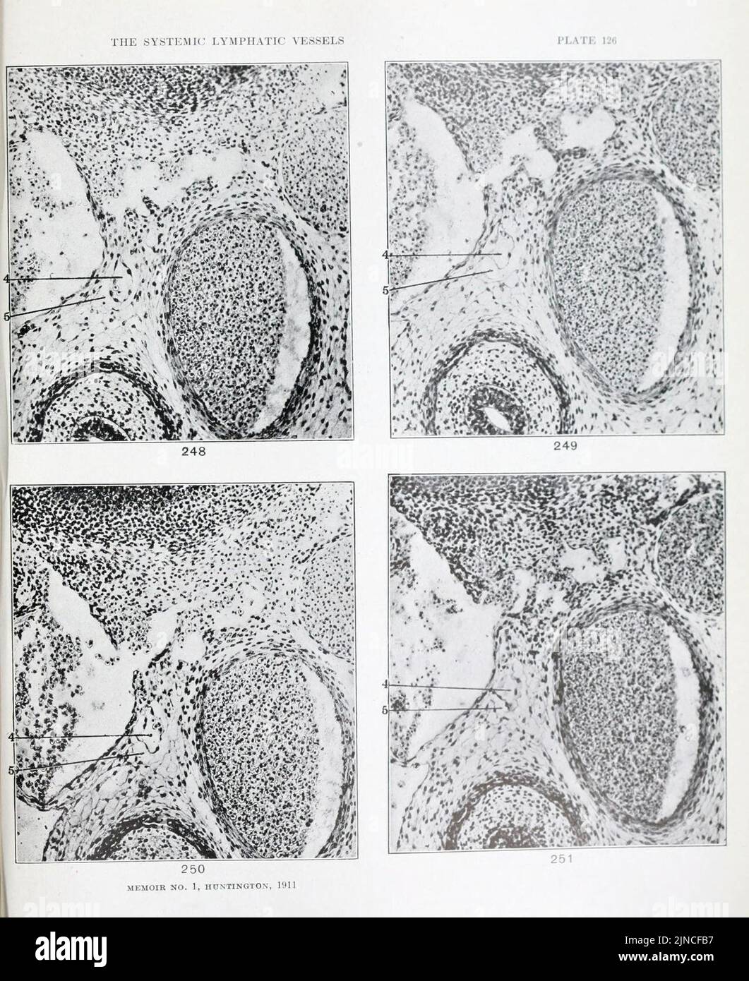 The anatomy and development of the systemic lymphatic vessels in the ...