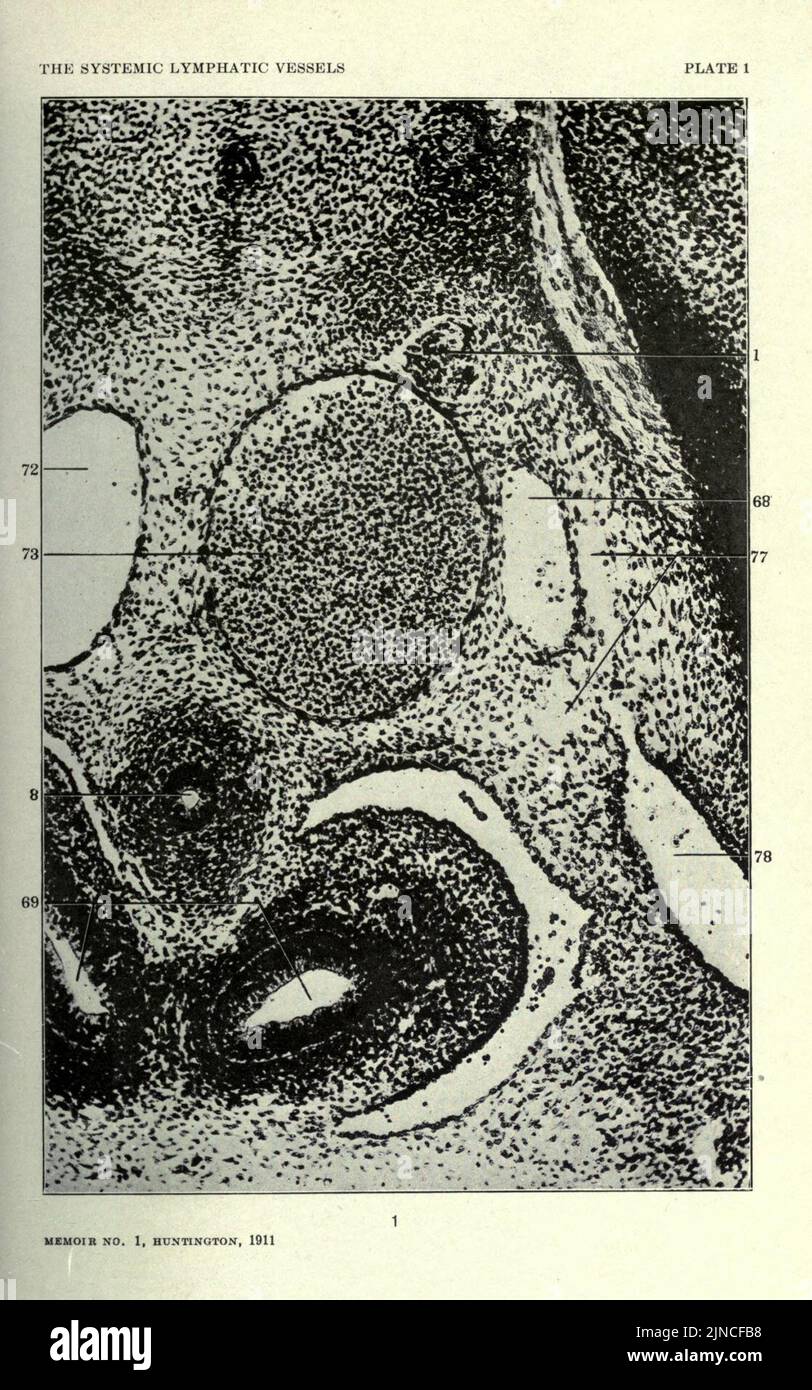 The anatomy and development of the systemic lymphatic vessels in the ...