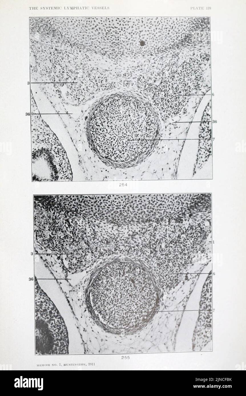 The anatomy and development of the systemic lymphatic vessels in the ...