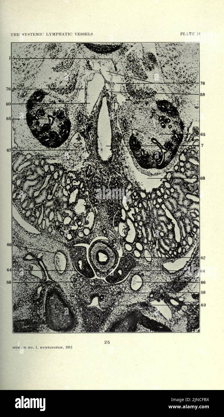 The anatomy and development of the systemic lymphatic vessels in the ...