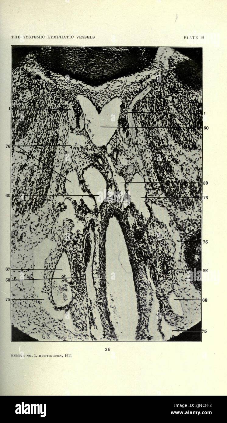 The anatomy and development of the systemic lymphatic vessels in the ...
