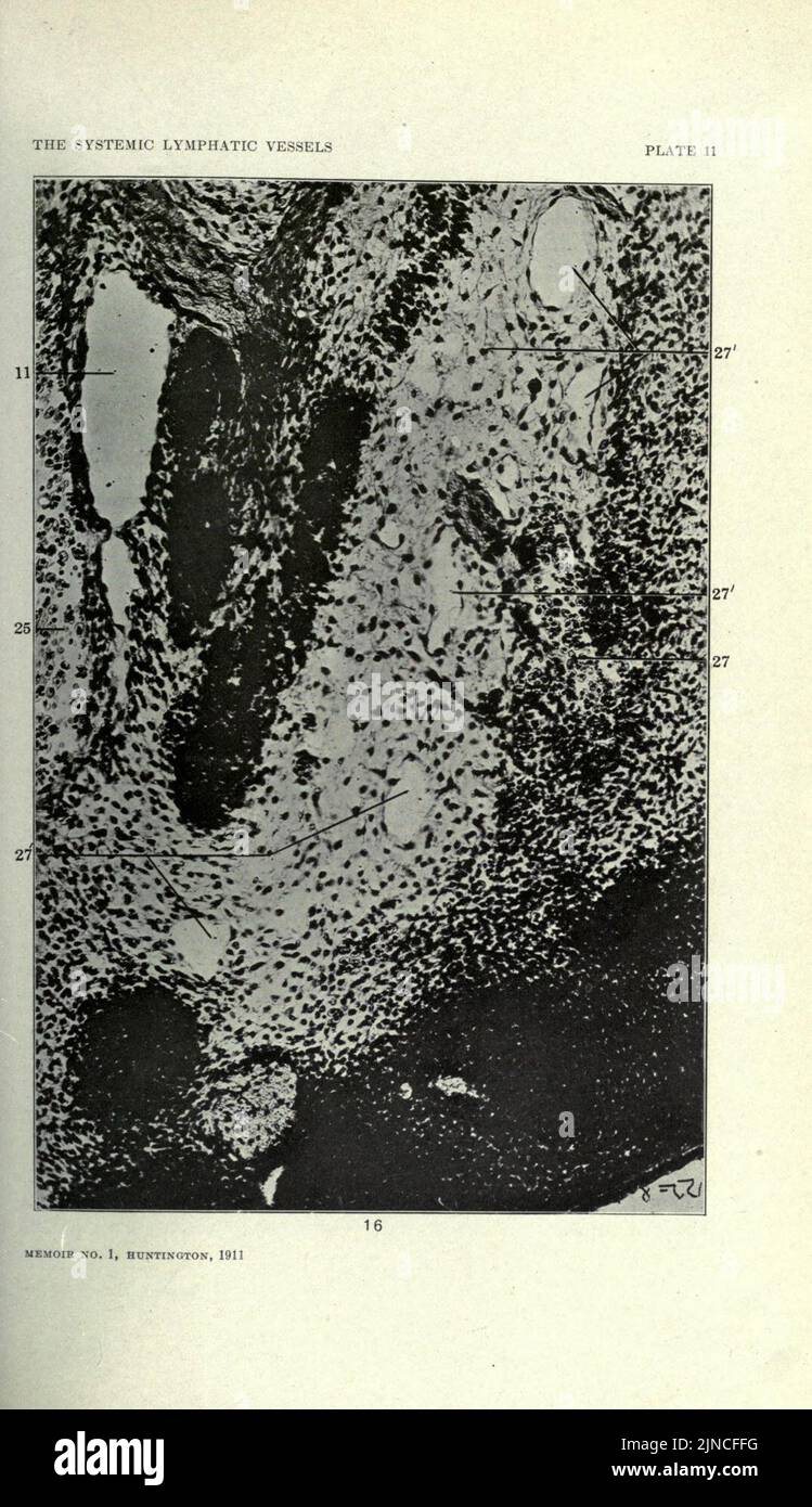 The anatomy and development of the systemic lymphatic vessels in the ...