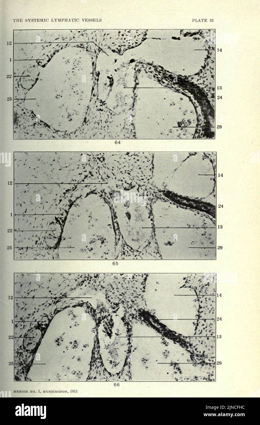 The anatomy and development of the systemic lymphatic vessels in the ...