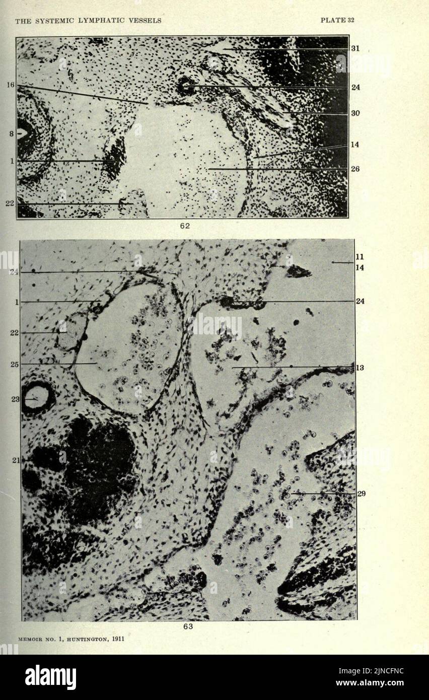The anatomy and development of the systemic lymphatic vessels in the ...